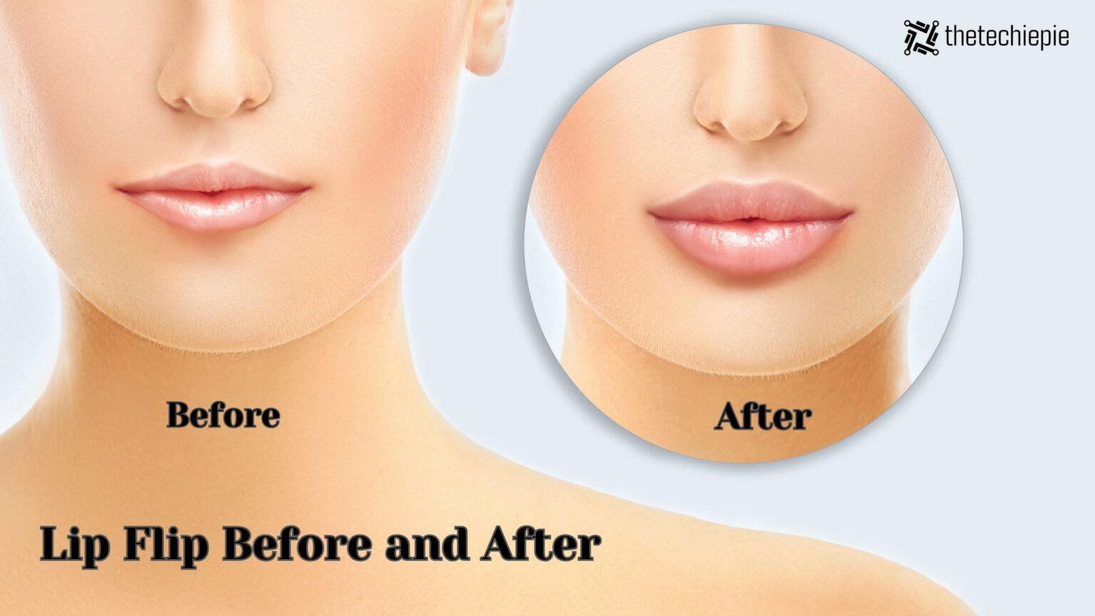 Lip Flip Before and After: How It Works, Types & Benefits