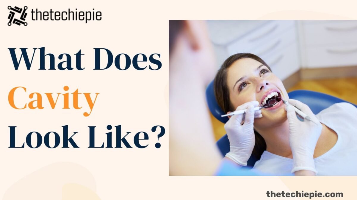 What Does a Cavity Look Like? Recognizing the Signs Stages and ...